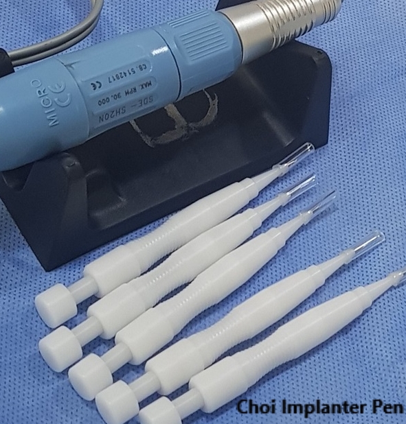 DHI Hair Transplant: 2025 - 2026 Guide